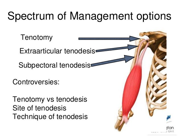 Biceps the enigmatic tendon