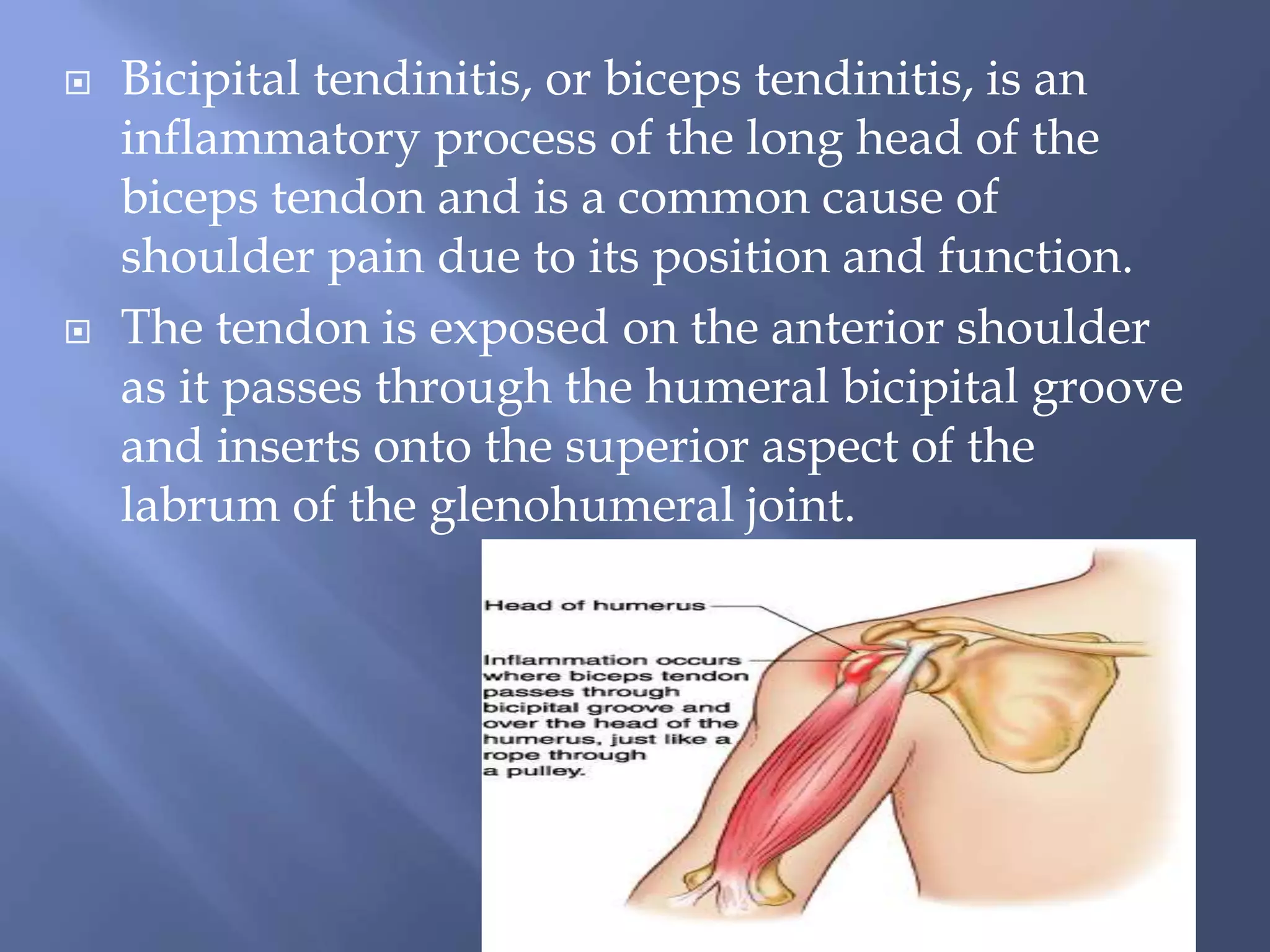 Bicipital tendonitis & Rehabilitation | PPTX