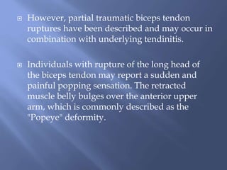 Bicipital tendonitis & Rehabilitation | PPTX