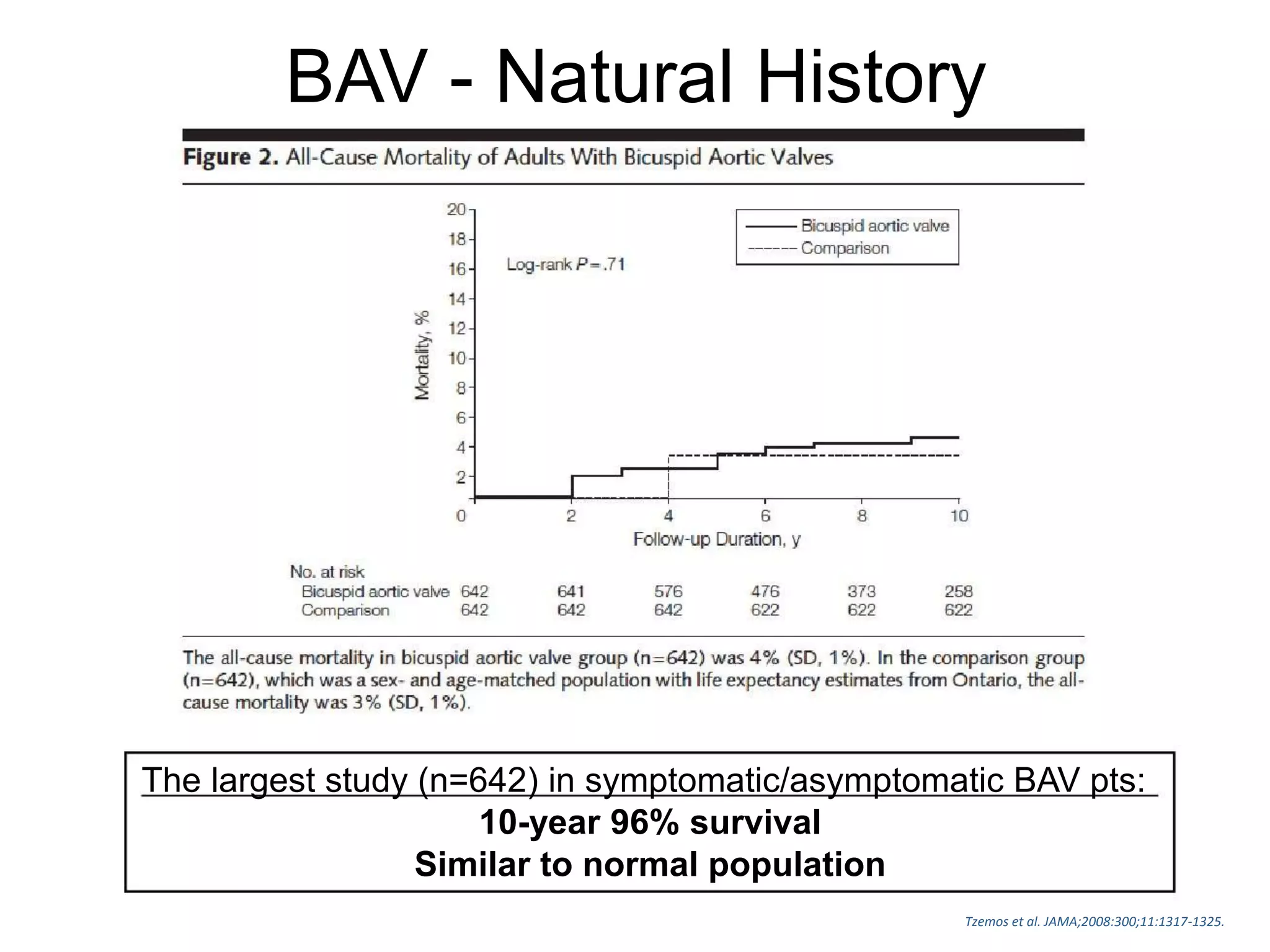Bicuspid aortic valve | PPTX