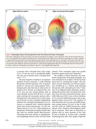 Bicuspid aortic valve pattern | PDF