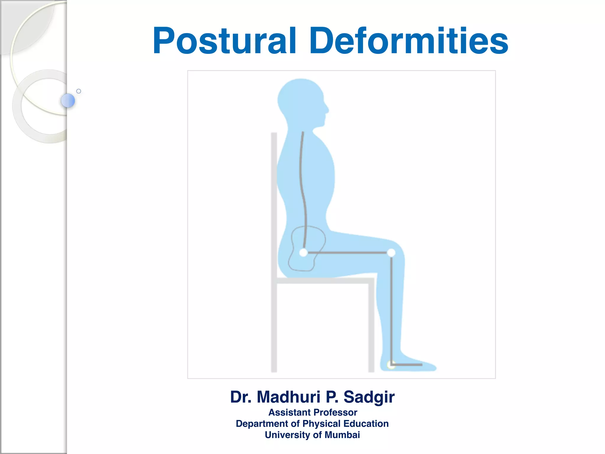 Posture and kyphosis_ | PDF