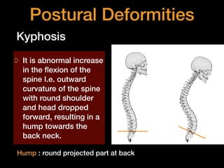 Posture and kyphosis_ | PDF