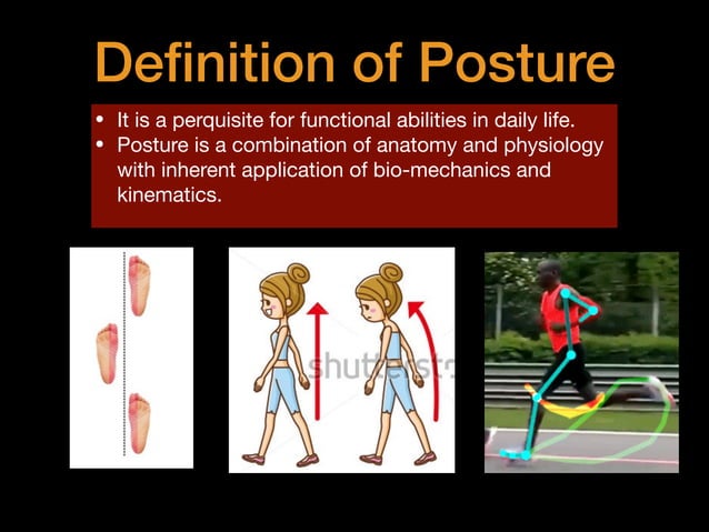 Posture and kyphosis_ | PDF | Physical Therapy | Wellness