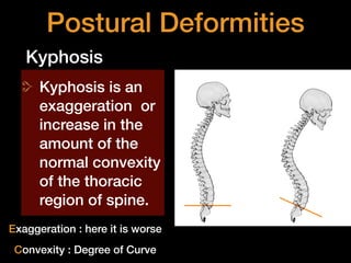 Posture and kyphosis_ | PDF