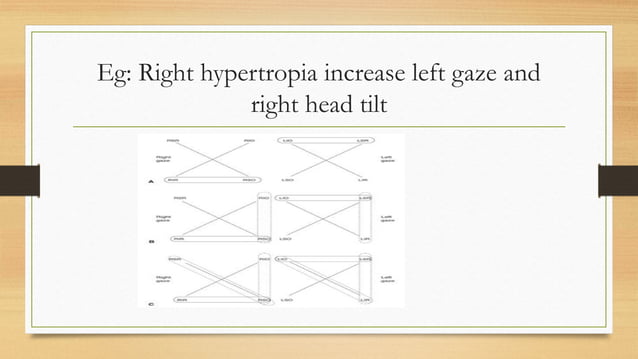Bielschowsky parks three step test presentation | PPTX