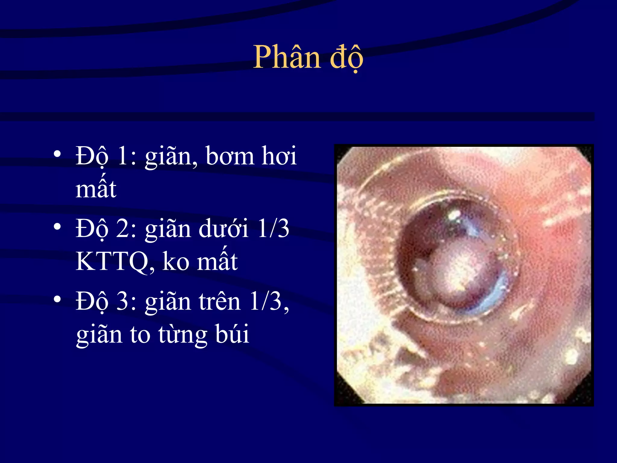 Bien chung va dieu tri xo gan | PPT