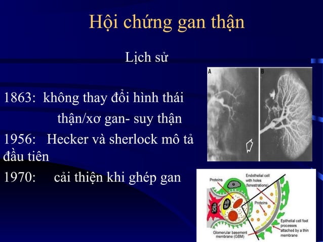 Bien chung va dieu tri xo gan | PPT