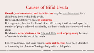 Bifid Uvula in childern , dono t take lightly, .pptx