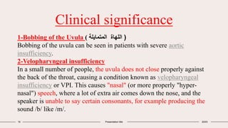 Bifid Uvula in childern , dono t take lightly, .pptx