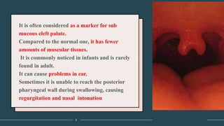Bifid Uvula in childern , dono t take lightly, .pptx