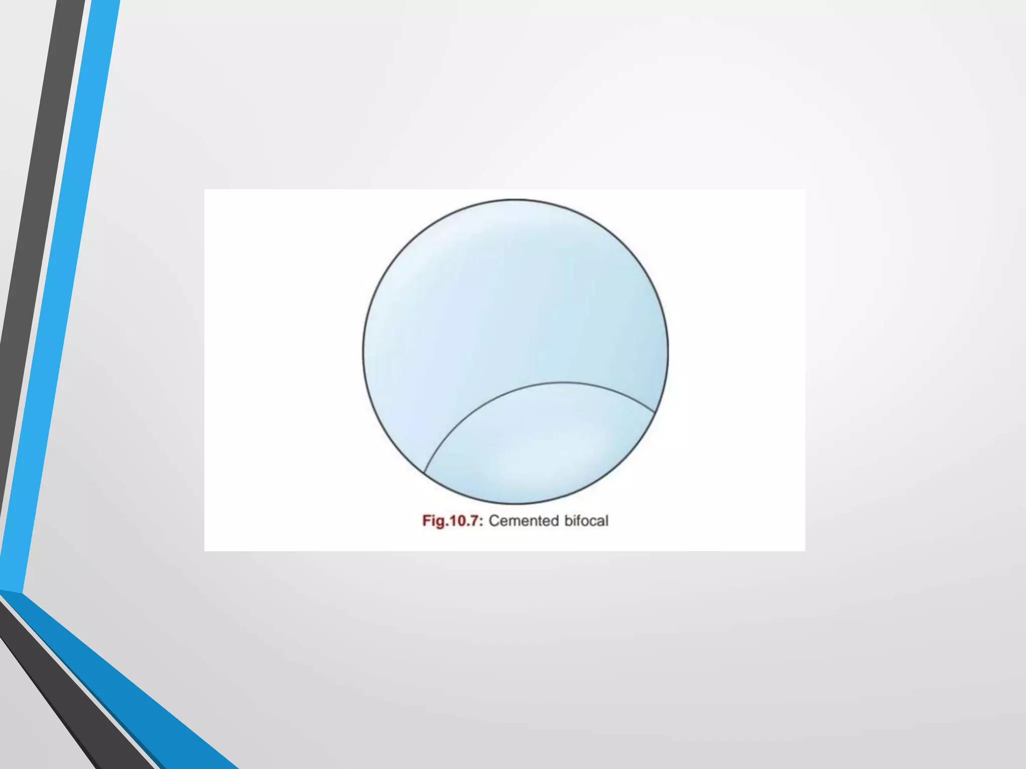 Bifocal lenses: types and principles | PPTX