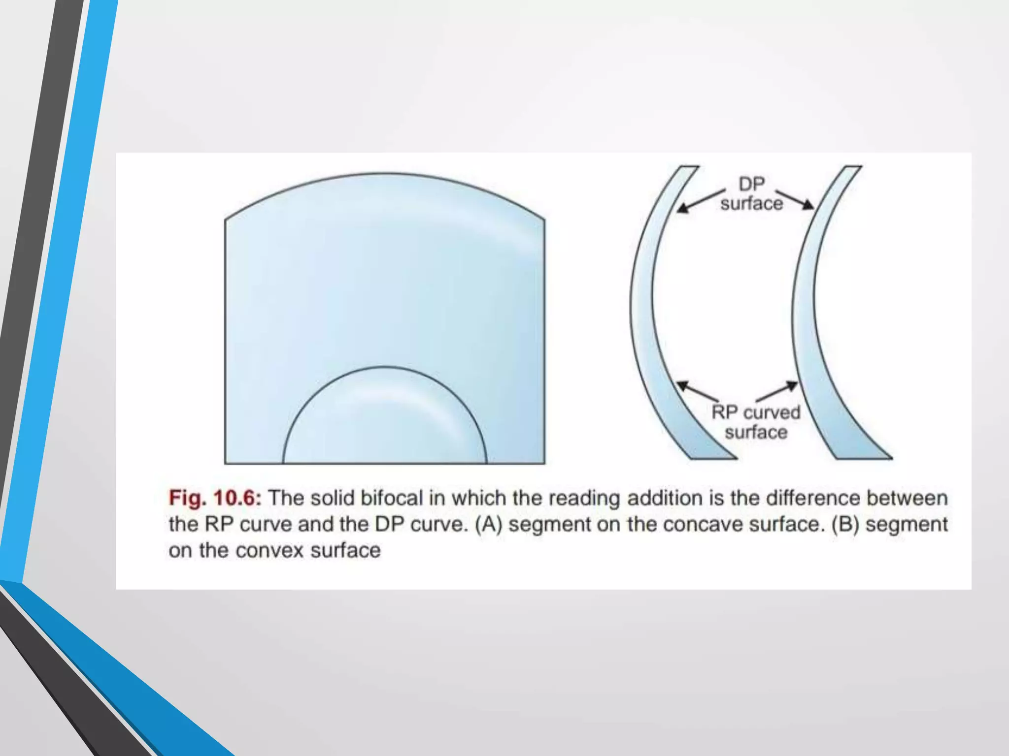 Bifocal lenses: types and principles | PPTX