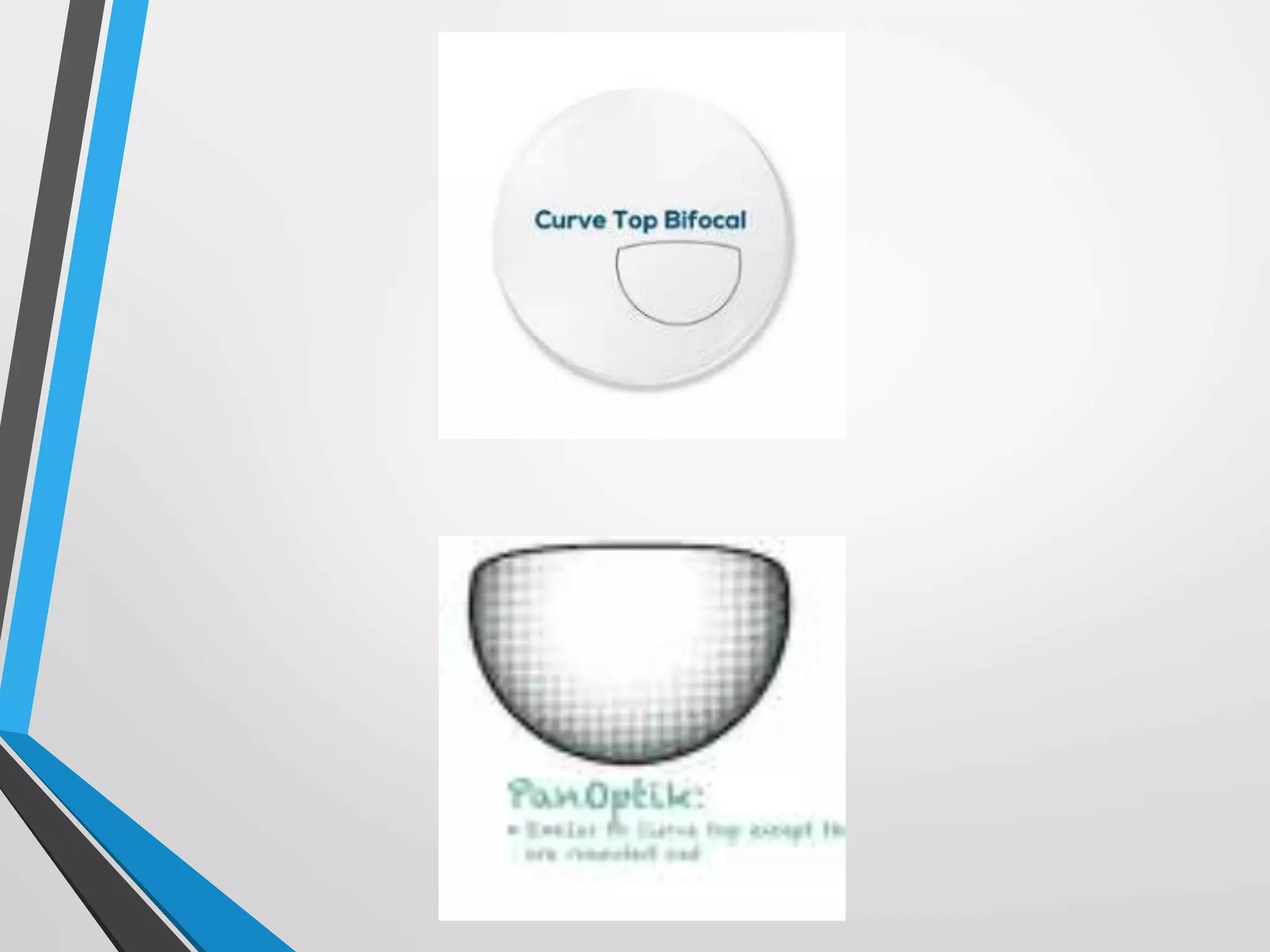 Bifocal lenses: types and principles | PPTX