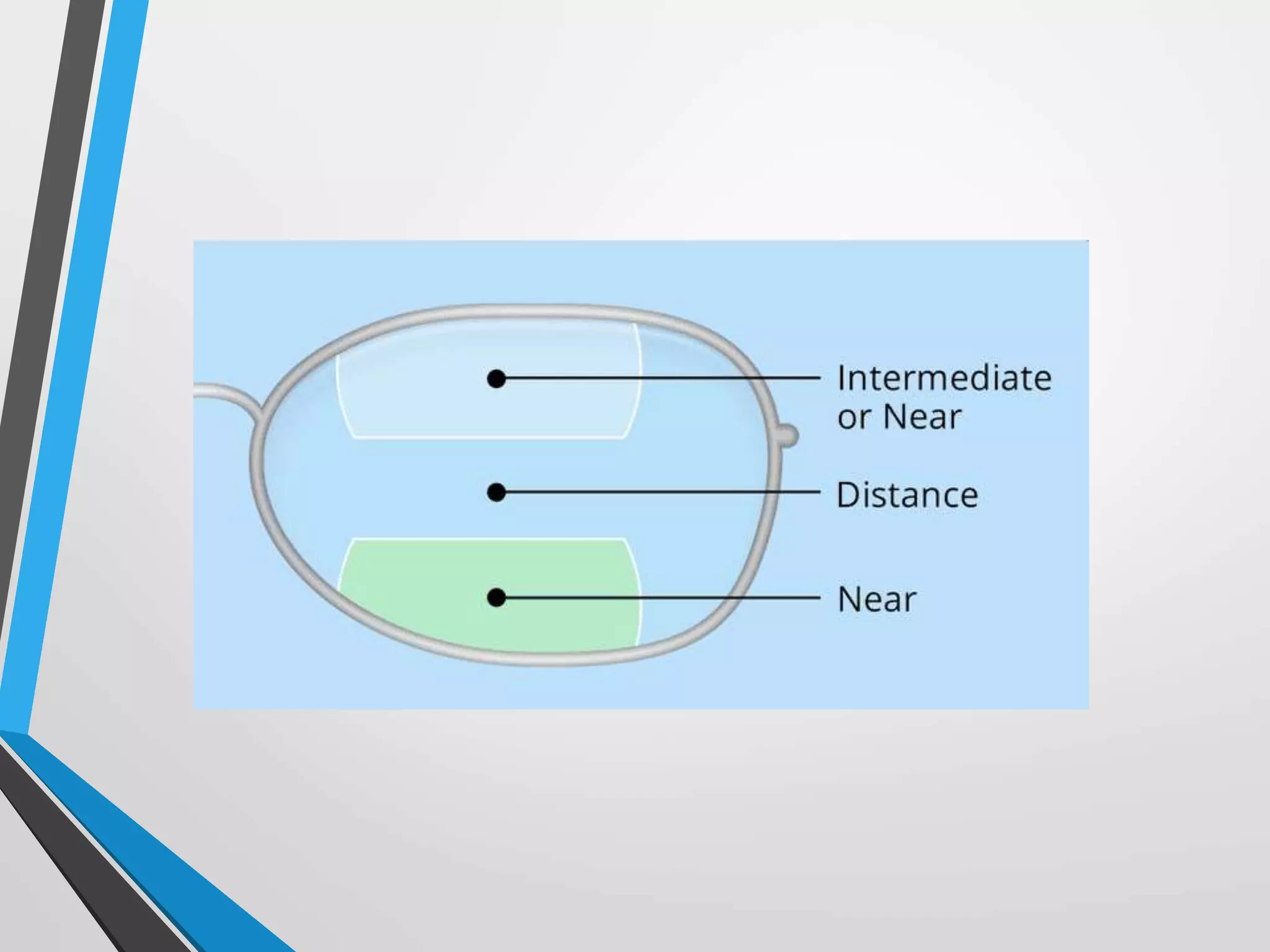 Bifocal lenses: types and principles | PPTX