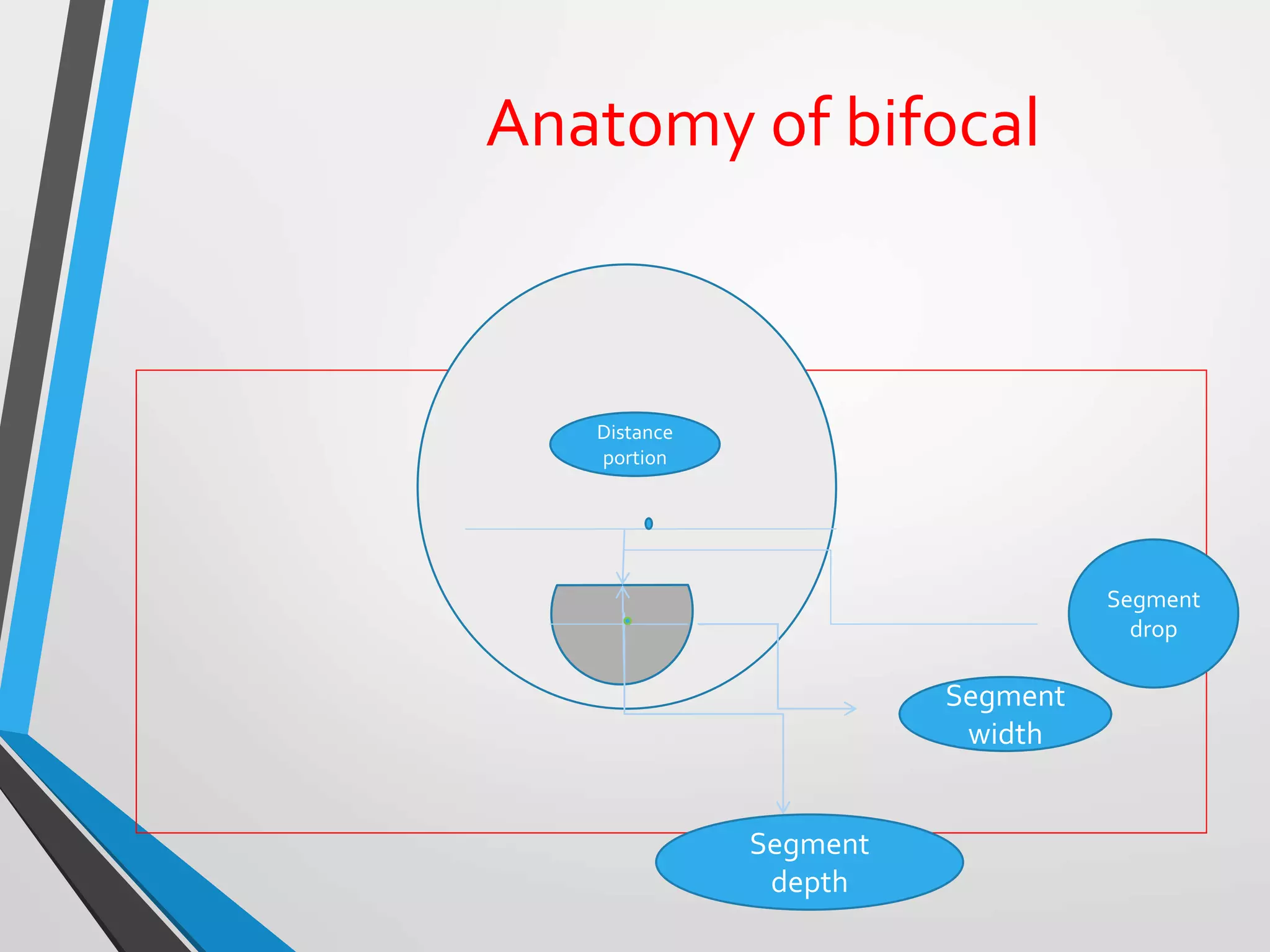Bifocal lenses: types and principles | PPTX