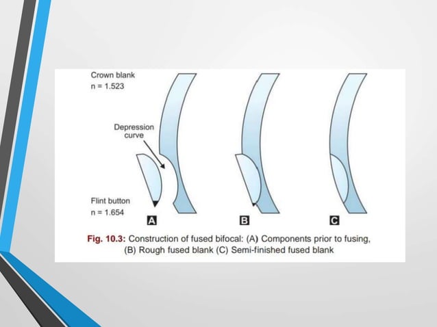 Bifocal lenses: types and principles | PPTX