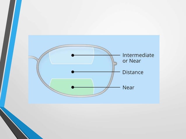 Bifocal lenses: types and principles | PPTX