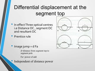 Bifocal lenses: types and principles | PPTX