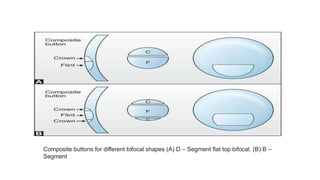 Bifocal Lenses on contact lenses ma.pptx