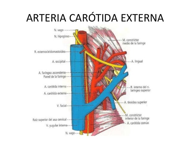 Bifurcación carotídea y carótida externa