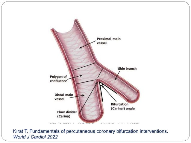Bifurcation Pptx