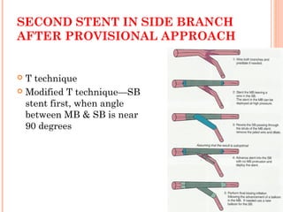 Bifurcation stenting | PPT