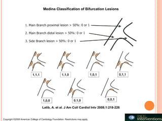 Bifurcation stenting | PPT