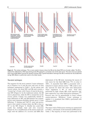 Bifurcation stenting | PDF