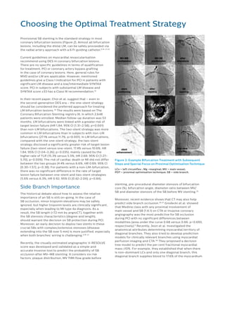 Bifurcation stenting | PDF