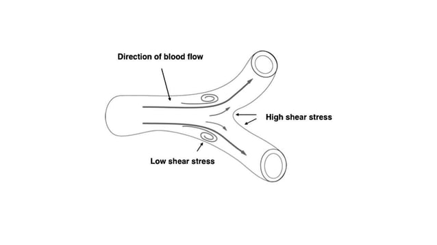 Bifurcation Stenting - BASICS.DR SADDAM HUSSAIN PGR CARDIOLOGY,MTI LRH.pptx