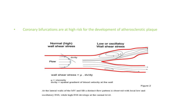 Bifurcation stenting seminar | PPT
