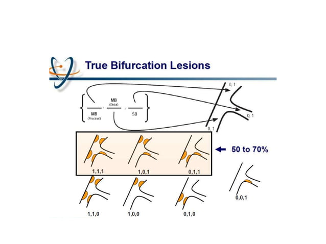 Bifurcation stenting strategies.ppt | Medical Health