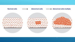 big-C.pdf power for colon and lung cancer presentation | PDF