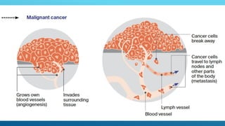 big-C.pdf power for colon and lung cancer presentation | PDF