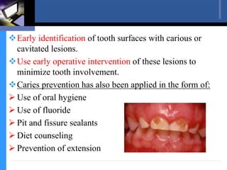 10 introduction to cariology ( dental caries) | PPTX