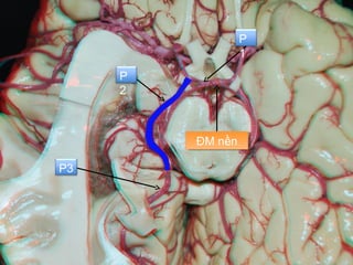 [Bài giảng, đầu mặt cổ] mang mach nao tuy | PPT