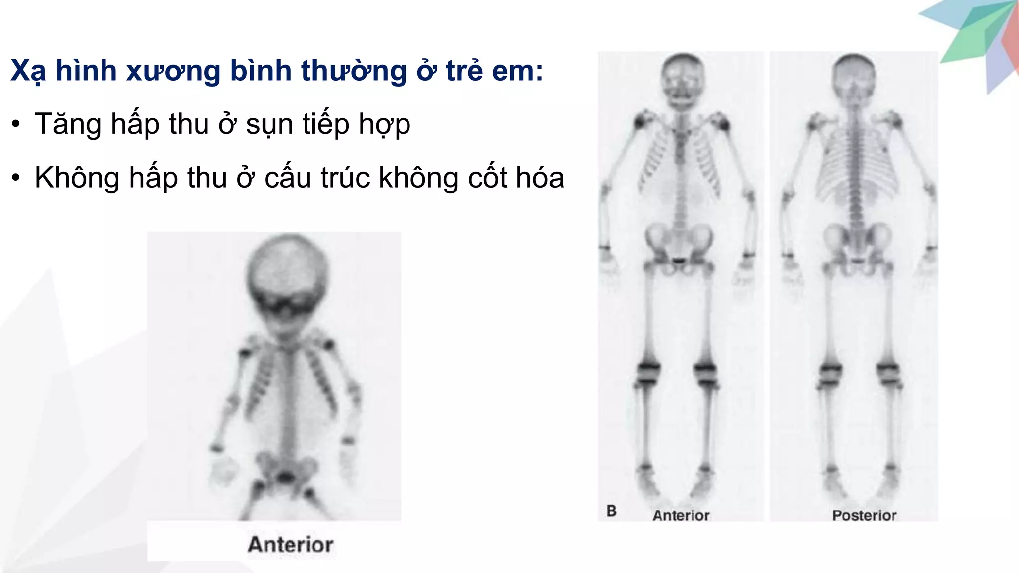 Bài giảng Xạ Hình Xương.pptx