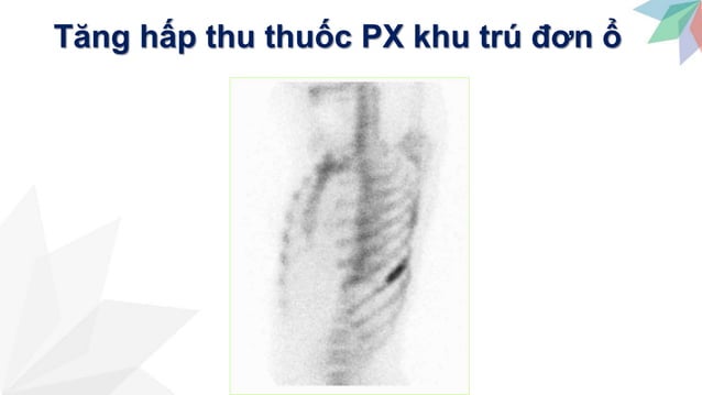Bài giảng Xạ Hình Xương.pptx