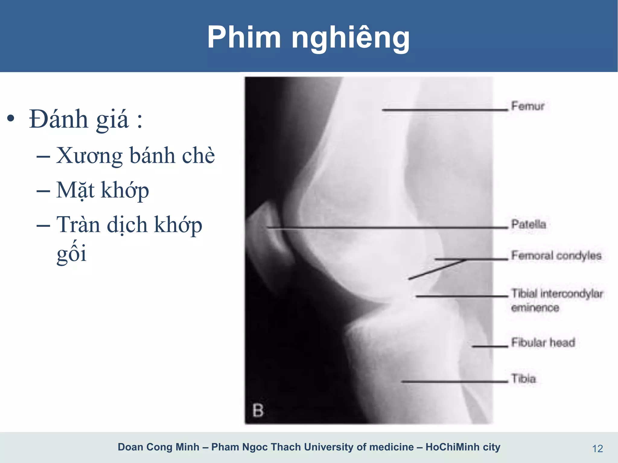 Bài giảng XQuang cơ xương khớp.pptx