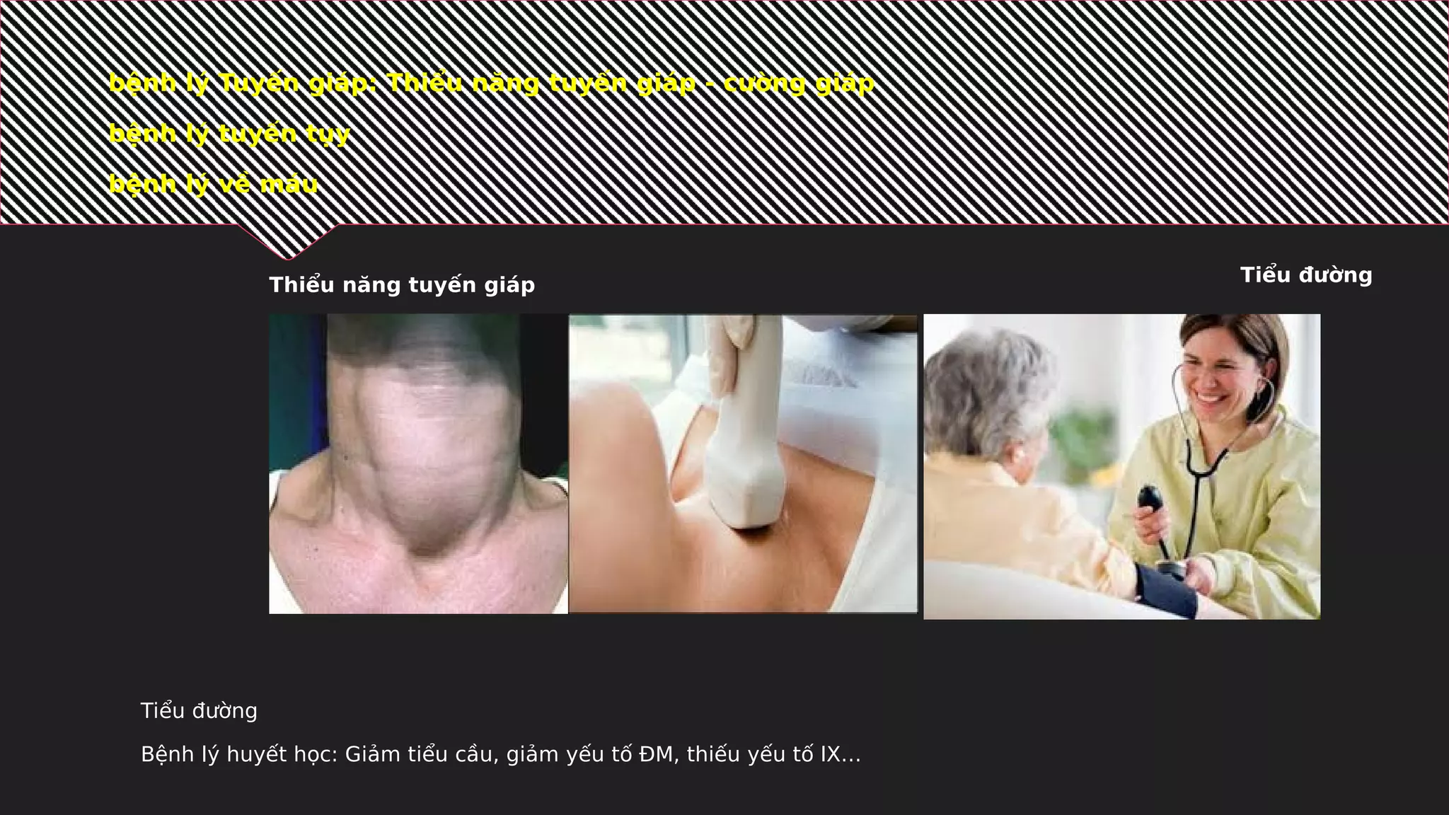 Bài Giảng Xuất Huyết Tử Cung Bất Thường.pdf