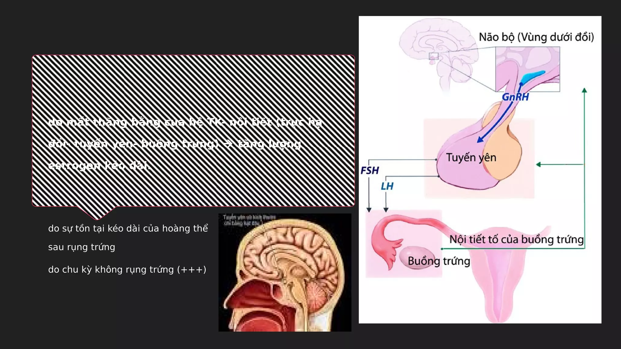 Bài Giảng Xuất Huyết Tử Cung Bất Thường.pdf