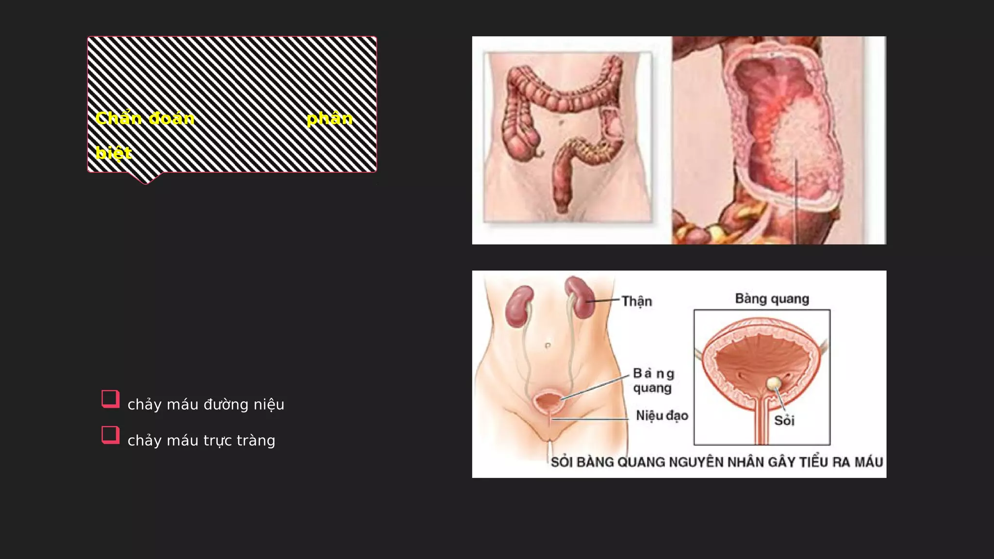 Bài Giảng Xuất Huyết Tử Cung Bất Thường.pdf