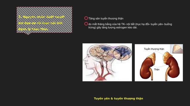 Bài Giảng Xuất Huyết Tử Cung Bất Thường.pdf