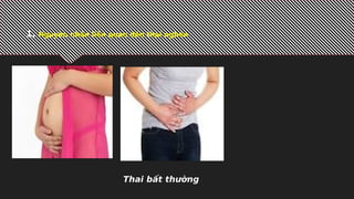 Bài Giảng Xuất Huyết Tử Cung Bất Thường.pdf