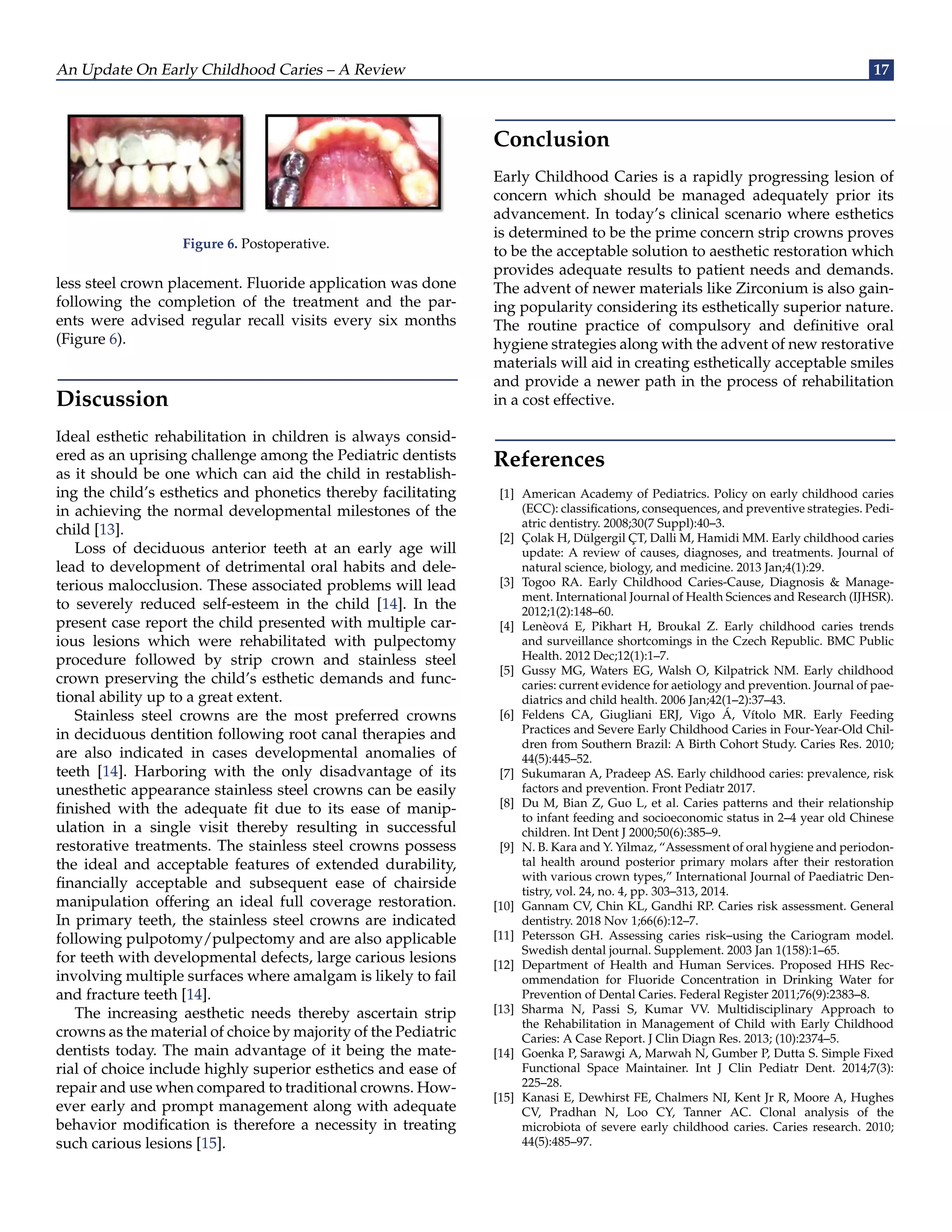 An Update On Early Childhood Caries – A Review | PDF