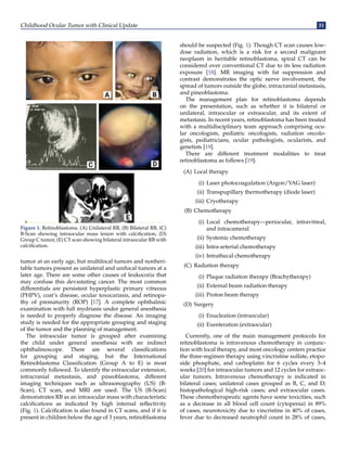 A Review of Childhood Ocular, Orbital, and Surface Tumors With Updated ...