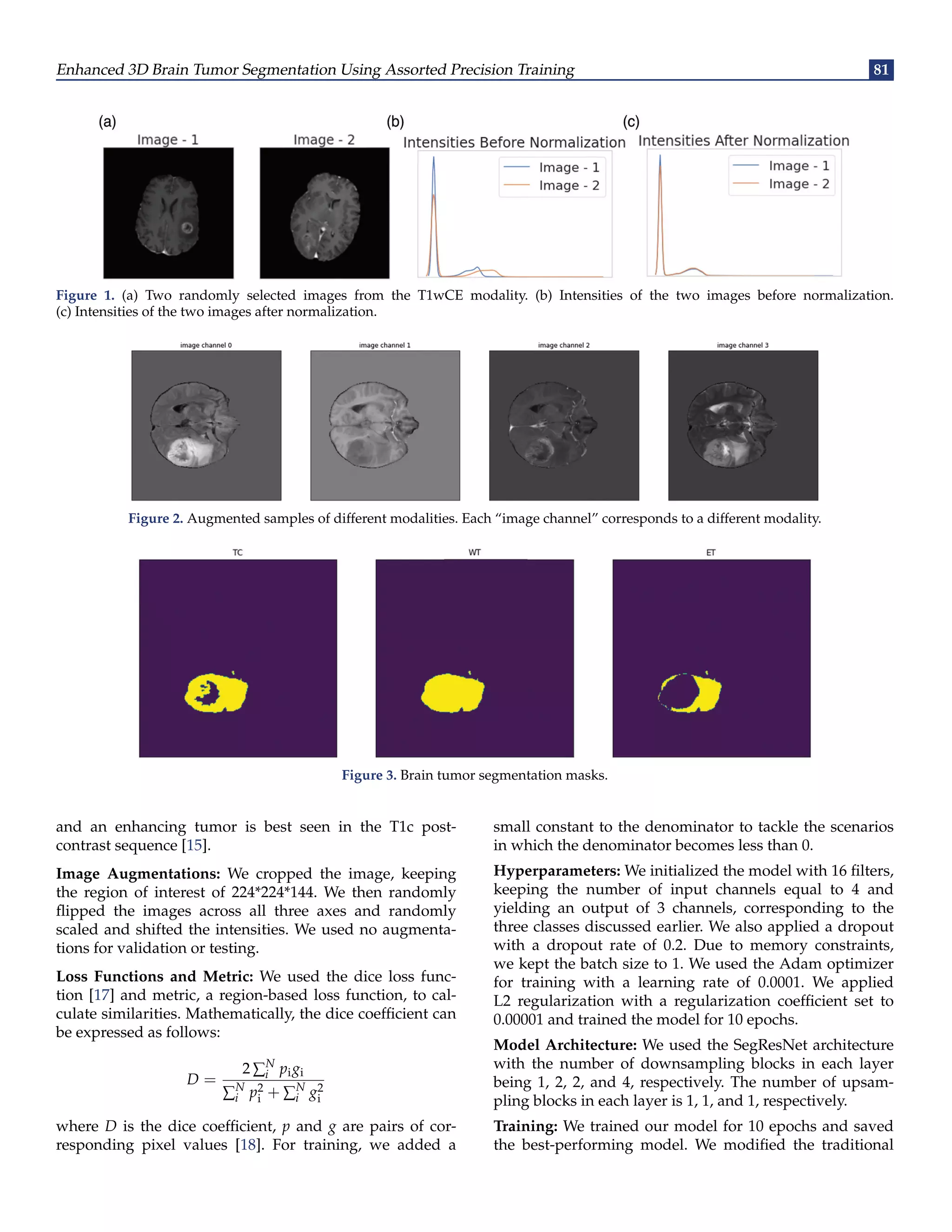 Enhanced 3d Brain Tumor Segmentation Using Assorted Precision Training
