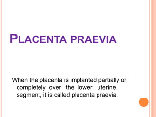 Placenta Praevia.pptx | Pregnancy | Reproductive Health