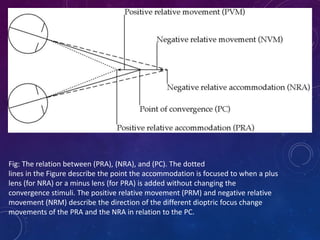 Accommodation/ Accommodation of Eye, Measurement of Accommodation of ...